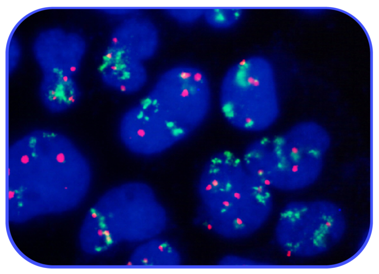 FISH en el diagnóstico y seguimiento oncológico - ANNAR Health ...