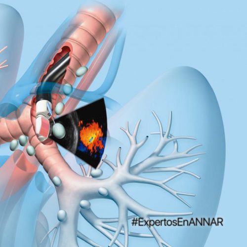 ToRCH: ¿Qué significa, qué enfermedades incluye? - ANNAR Health ...