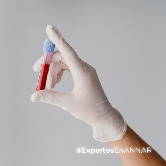 Medición de Calprotectina, aspectos a tener en cuenta para la ...