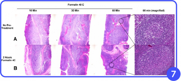 Estandarización en la fase preanalítica de fijación con formol buferado ...