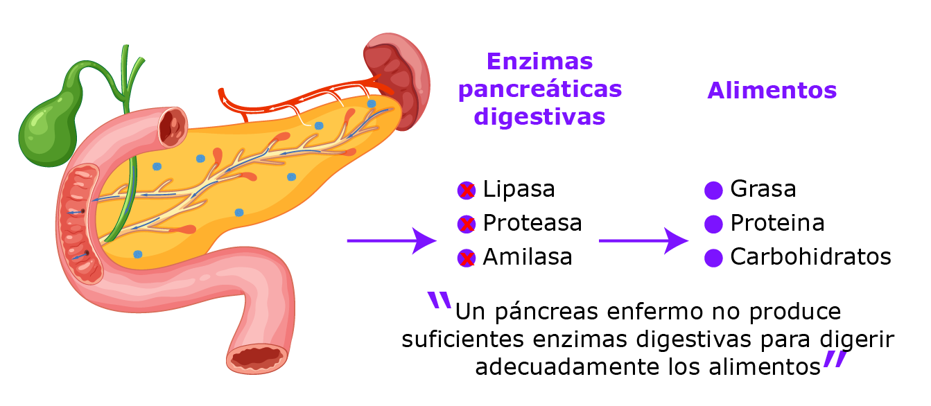 Qué Sabes Acerca De La Elastasa Pancreática Annar Health