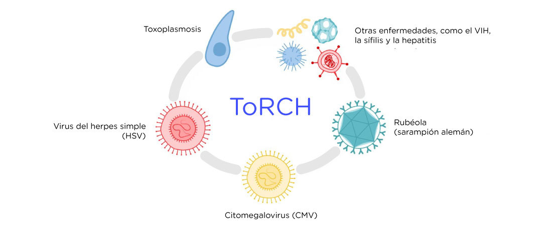 ToRCH: ¿Qué significa, qué enfermedades incluye? - ANNAR Health ...