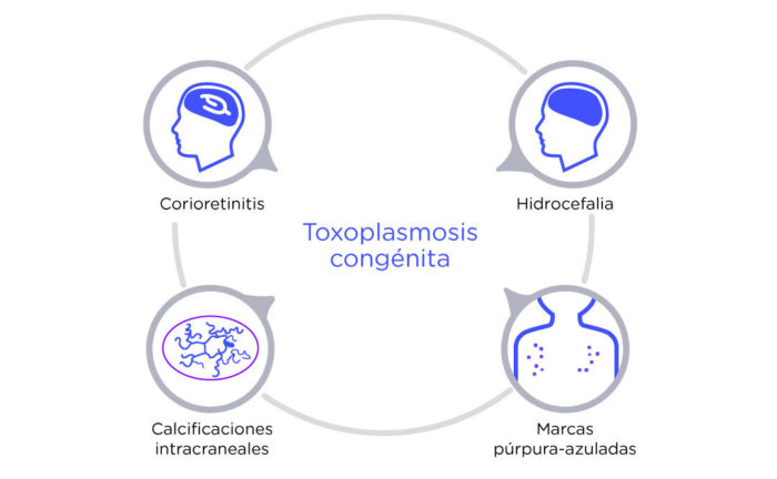 ToRCH: ¿Qué significa, qué enfermedades incluye? - ANNAR Health ...