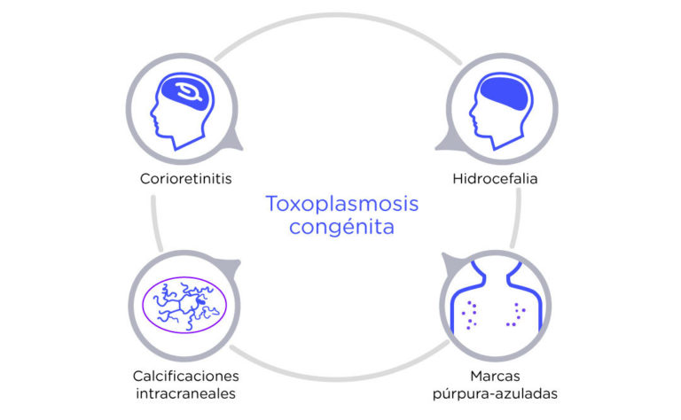 ToRCH: ¿Qué significa, qué enfermedades incluye? - ANNAR Health ...