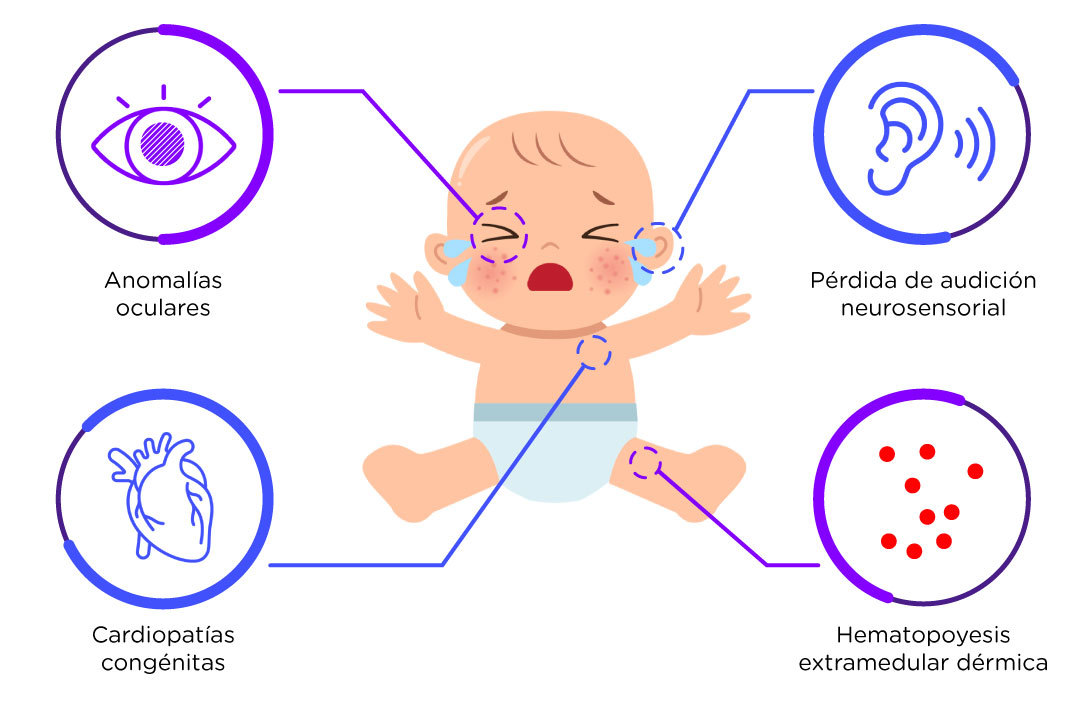 ToRCH: ¿Qué significa, qué enfermedades incluye? - ANNAR Health ...