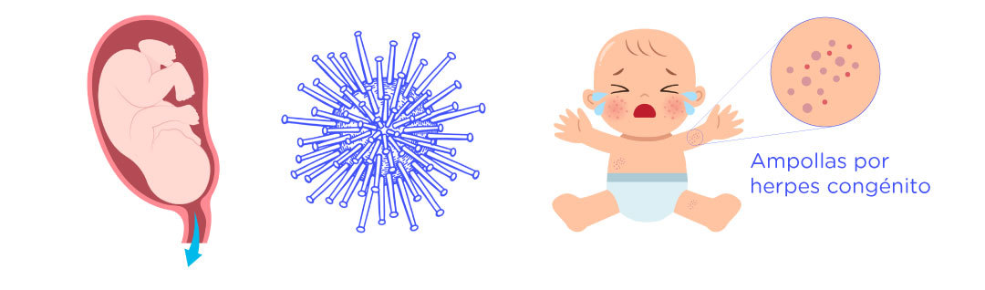 ToRCH: ¿Qué significa, qué enfermedades incluye? - ANNAR Health ...