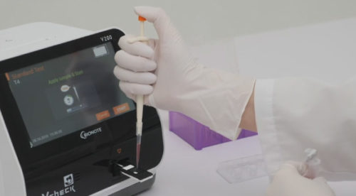 Vcheck V200 - ANNAR Health Technologies - Colombia